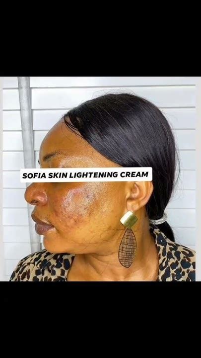 Sofia Skin Lightening Cream Whatsapp Us 27710815970 Youtube