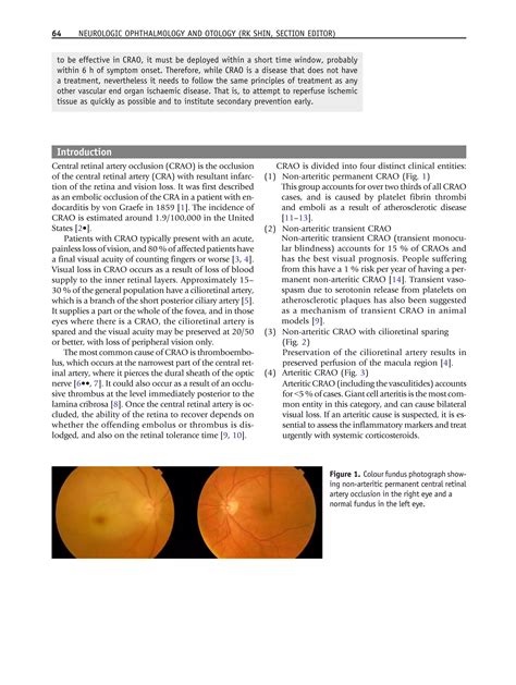 Treatment Options For Central Retinal Artery Occlusion 2012 Pdf