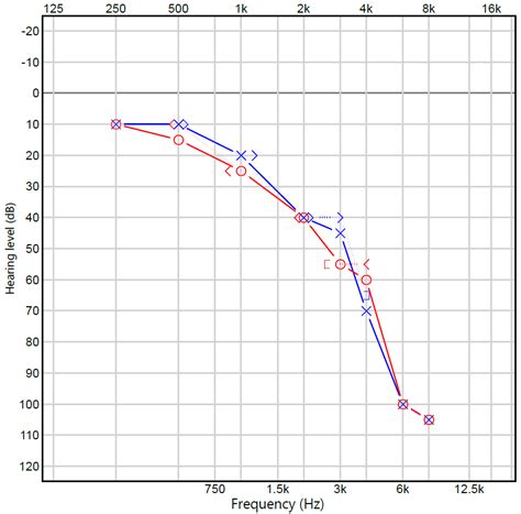 What Is An Audiogram Knox Audiology Knox Hearing Clinics