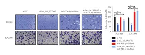 Changes In The Proliferation And Invasion Of BGC 823 And SGC 7901 Cells