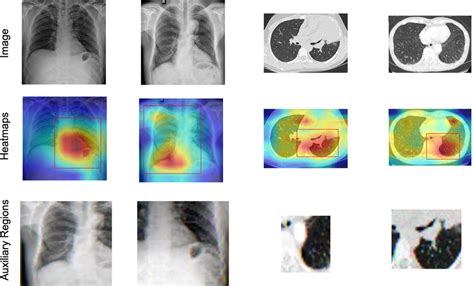sample output of our approach on both cx chr and cov ctr datasets we