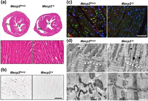 Histological Analysis Of Hearts From Mecp2 Null Mice A Download