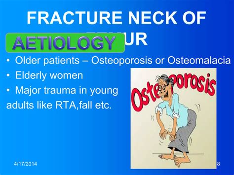 Fracture Neck Femur Ppt
