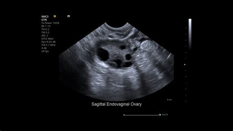 Acuson Juniper Is A High Performance Shared Service Ultrasound System