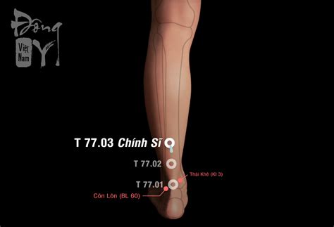 T7703 HuyỆt ChÍnh SĨ Dr Troi