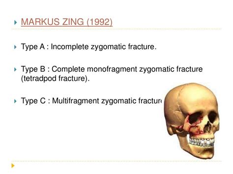Classification Of Mandible Midface Zmc And Noe Fractures