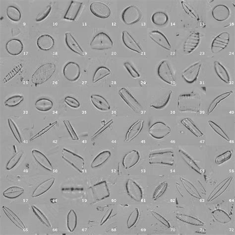 Diatom Classes Examples For Segmented Dataset Download Scientific