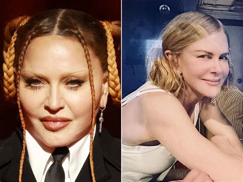 Pillow Face Is The Latest Celebrity Cosmetic Surgery Fail Check It Out