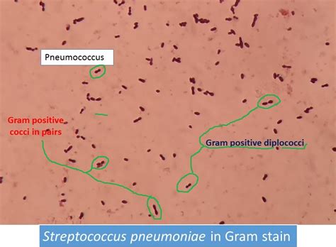 Streptococcus Pneumoniae Under Microscope