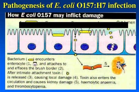 Ppt E Coli 0157h7 A New Emerging Disease Powerpoint Presentation