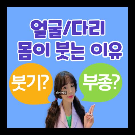 얼굴 붓는 이유 손 발 하체 하지 부종 종아리 혈관 다리 부종 원인 네이버 블로그
