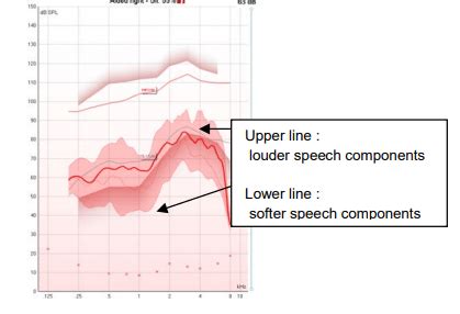 Affinity Compact Visible Speech Mapping Interacoustics