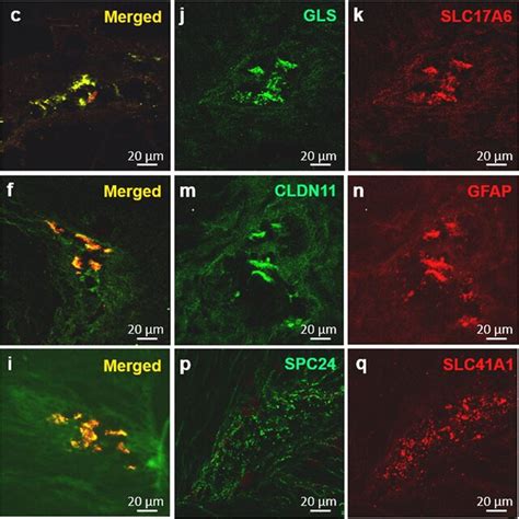 Validation Of Discriminatory Marker Genes For Major Classes Of Enteric