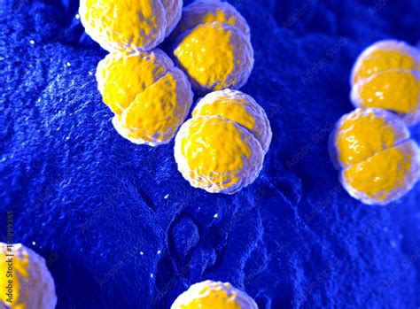 Neisseria Meningitidis Or Meningococcus Bacterium Can Cause Meningitis