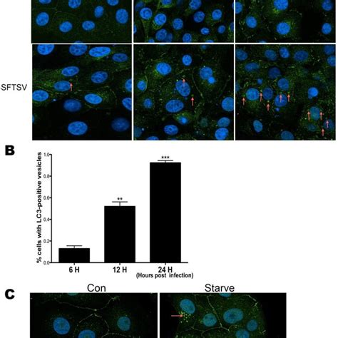 Nss Protein Of Sftsv Co Localizes With Lc3 A In Sftsv Infected Download Scientific Diagram