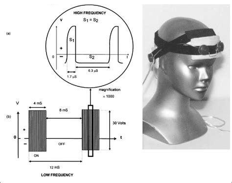 Figure From Noninvasive Brain Stimulation With Low Intensity Electrical Currents Putative