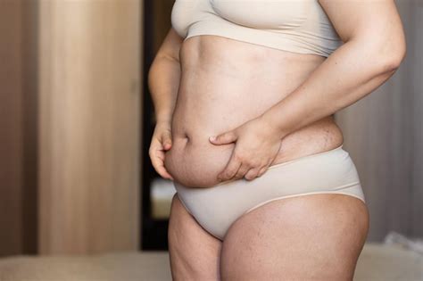 Premium Photo Cropped Image Of Overweight Woman Tucking Hiding Fat Naked Big Excessive Abdomen