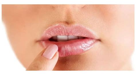 Todo Lo Que Necesita Saber Sobre Los Herpes Labiales Odontologos Co