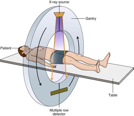 Basic Principles In Computed Tomography CT Thoracic Key