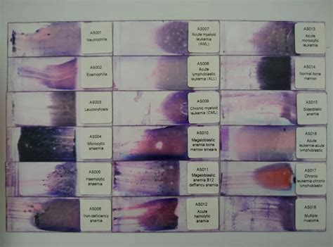 18pcs Hematology Prepared Slides Blood Smear Prepared Slides Buy