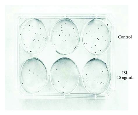A The Colony Formation Assay Was Visualized And Evaluated By Crystal