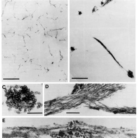 Electron Micrographs Of Thin Sections Showing The Effect Of Actophorin Download Scientific