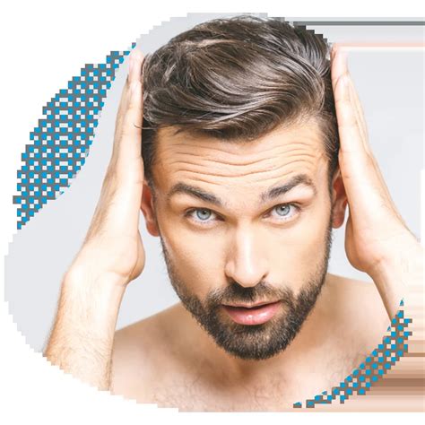 Dhi Hair Transplant Turkey Aesthetic Travel In Antalya