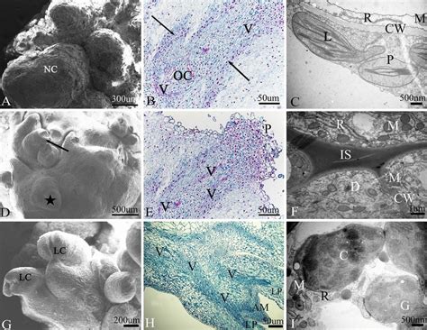 Sem Histological And Cytological Observation Of Callus After 712