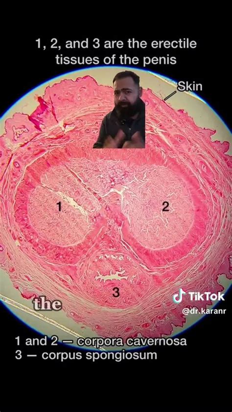 Doctor Shows Slice Of Penis Under Microscope And Leaves Men Squirming Daily Star