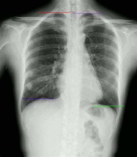 konica minolta healthcare emea on linkedin ddr medicalimaging xray