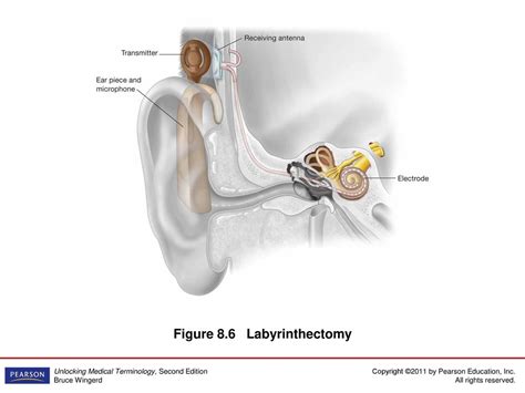 The Special Senses The Ears Ppt Download