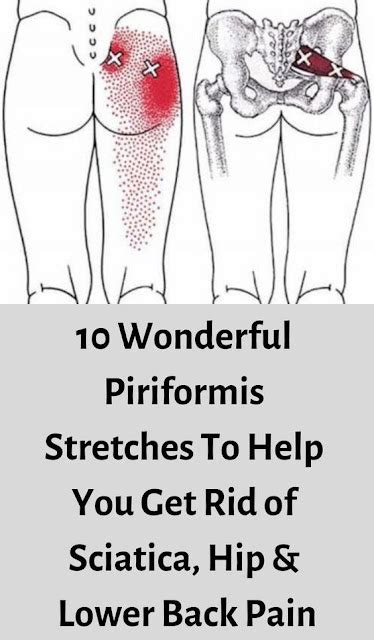 10 Piriformis Stretches To Help You Get Rid Of Sciatica Hip And Lower