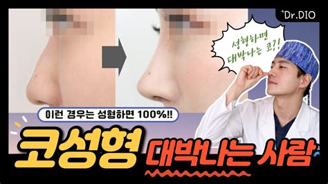 [eng 성형지식] 성형 하면 완전 대박날 코는 따로 있다 코성형 대박나는 코 🤩 Youtube