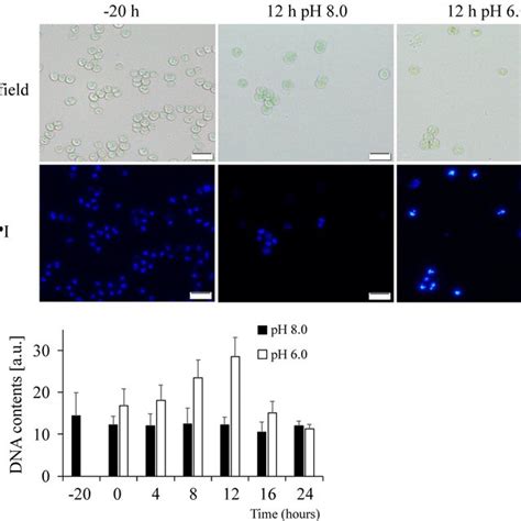 The Effect Of Acidic Stress In Synechocystis 6803 Synechocystis 6803