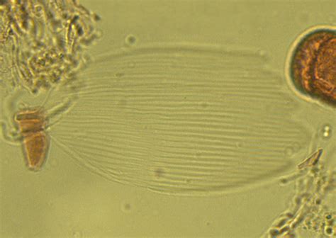 Fossil Moth Scales Can Uncover Prehistoric Secrets Scientists Say