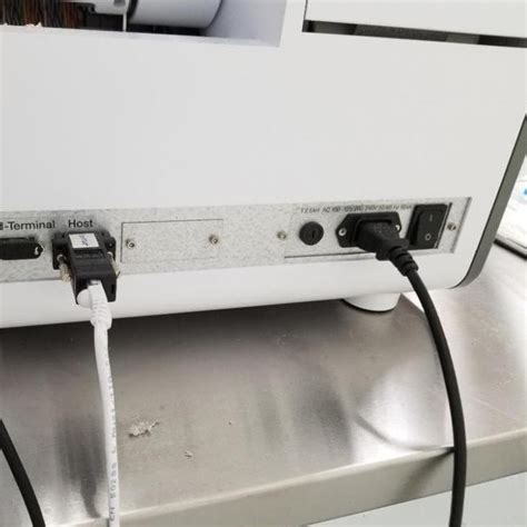 How Does A Urine Analyzer Workaoemscom