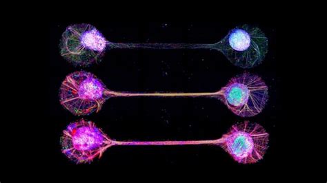 Mini Brains Wired Scientists Grow Brain Like Thinking Tissues In Lab