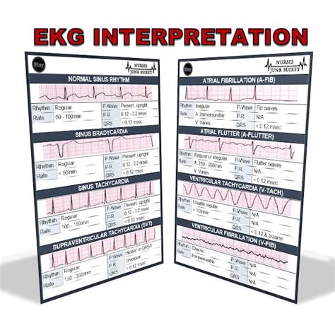 Ekg Cheat Sheet Badge Buddy Etsy