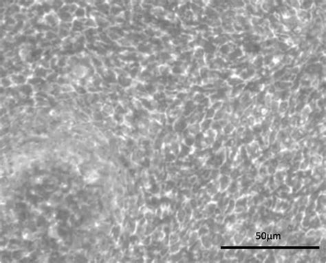 Dense Distribution Of Epithelial Cells Seen On Light Microscopy ×20
