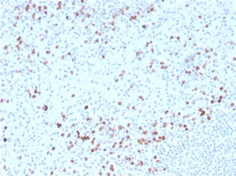 Granzyme B Nkt Cell Lymphoma Marker Monoclonal Antibody Gzmb3014