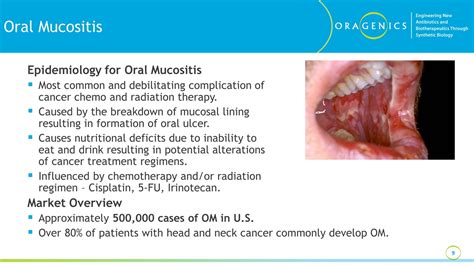 Radiation Mucositis Ppt At Greg Howell Blog