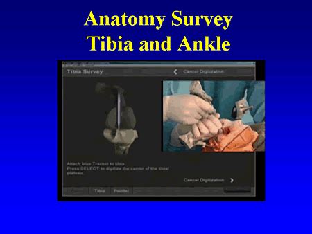 Clinical Counterpoints New Techniques In Total Knee Arthroplasty And Pain Management