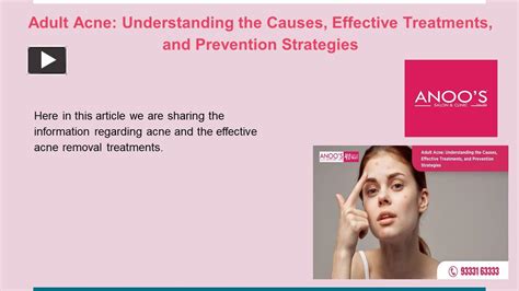 Ppt Adult Acne Understanding The Causes Effective Treatments And Prevention Strategies