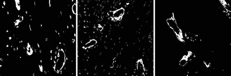 the results of the image segmentation obtained applying the classical