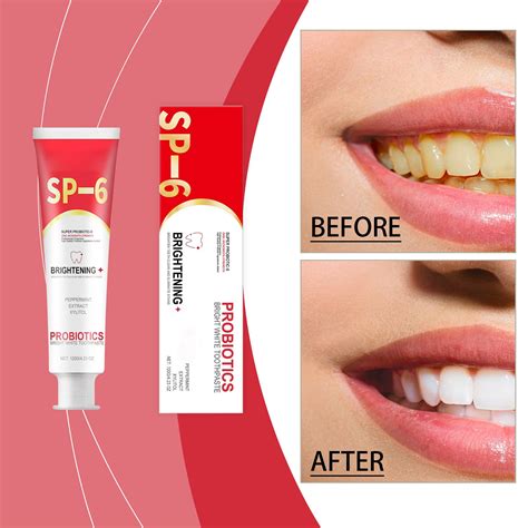 Luoyinda Braces Care Products Mouthwash Probiotic Toothpaste For Teeth