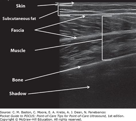 Lec 8 Msk Ultrasound Flashcards Quizlet