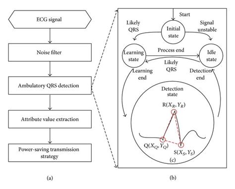 Ambulatory Ecg Analyzing Framework On The Sensor Node A Ecg Download Scientific Diagram