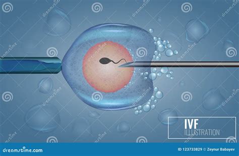 In Vitro Fertilization Injection Artificial Insemination Scientific