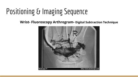 Arthrography Of The Shoulder Ankle And Wristpptx Arthrography Of The Shoulder Ankle And Wristpptx