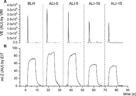 Vibration Response Imaging Semantic Scholar